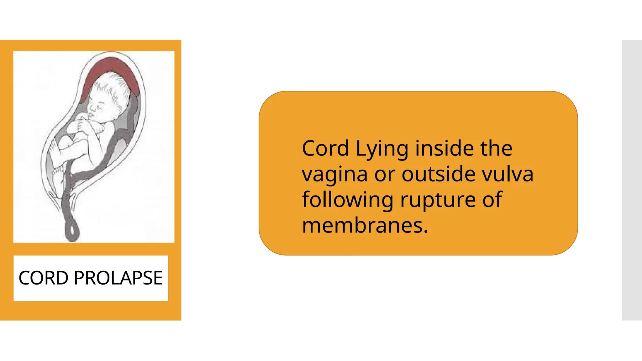cord prolapse and presentation BY ANUSHRI SRIVASTAVA.pptx