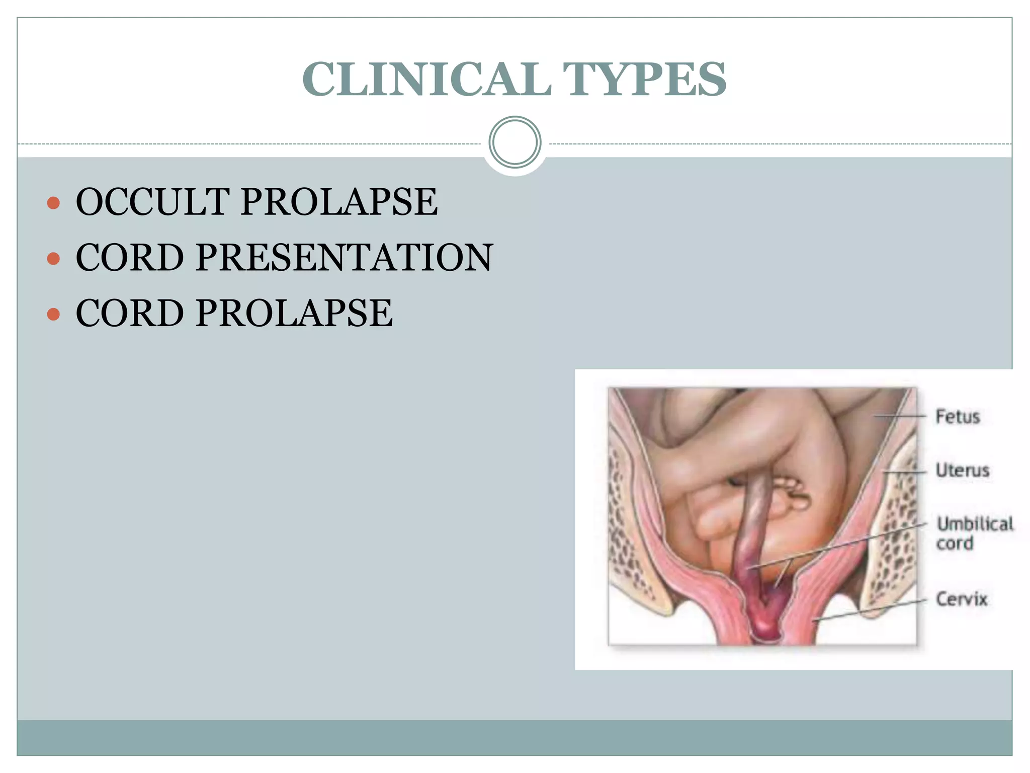 Cord prolapse & cord presentation | PPTX