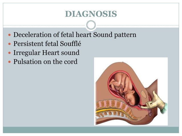 Cord prolapse & cord presentation | PPTX | Pregnancy | Reproductive Health