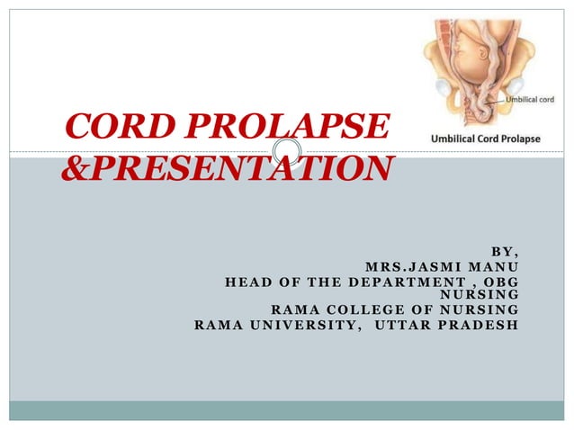 Cord prolapse & cord presentation | PPT