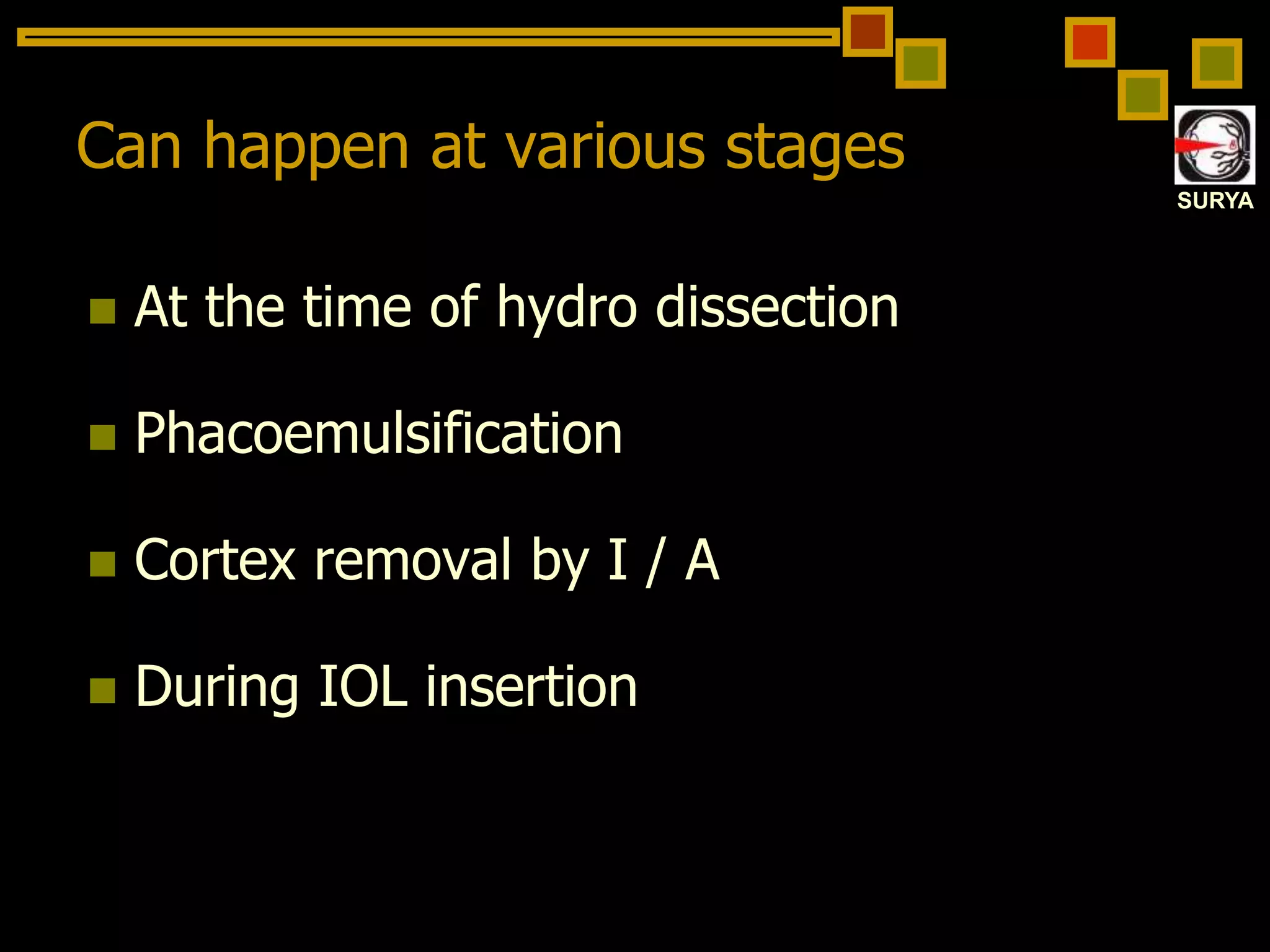 Core anterior vitrectomy DR AJAY DUDANI | PPT | Eye and Vision ...