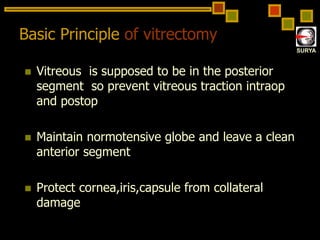 Core anterior vitrectomy DR AJAY DUDANI | PPT | Eye and Vision ...