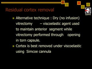 Core anterior vitrectomy DR AJAY DUDANI | PPT | Eye and Vision ...