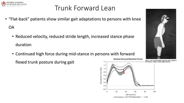 Core Dysfunction in children with CP.pptx