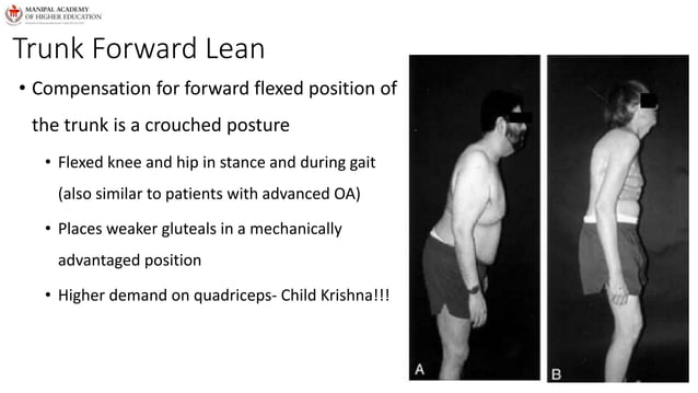 Core Dysfunction in children with CP.pptx