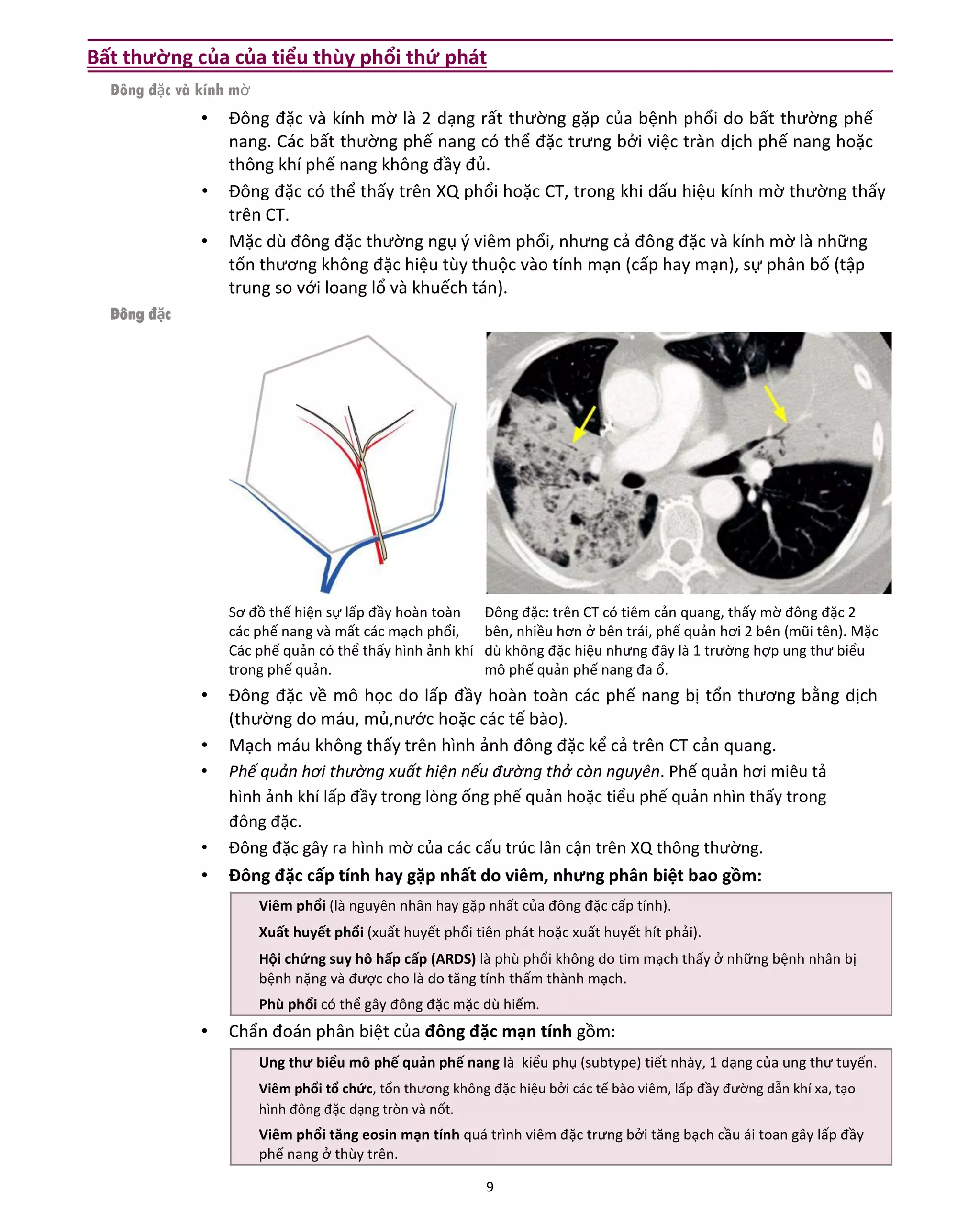 Core_Radiology_A_Visual_Approach_to_Diagnostic_Imaging_914trangvi.pdf
