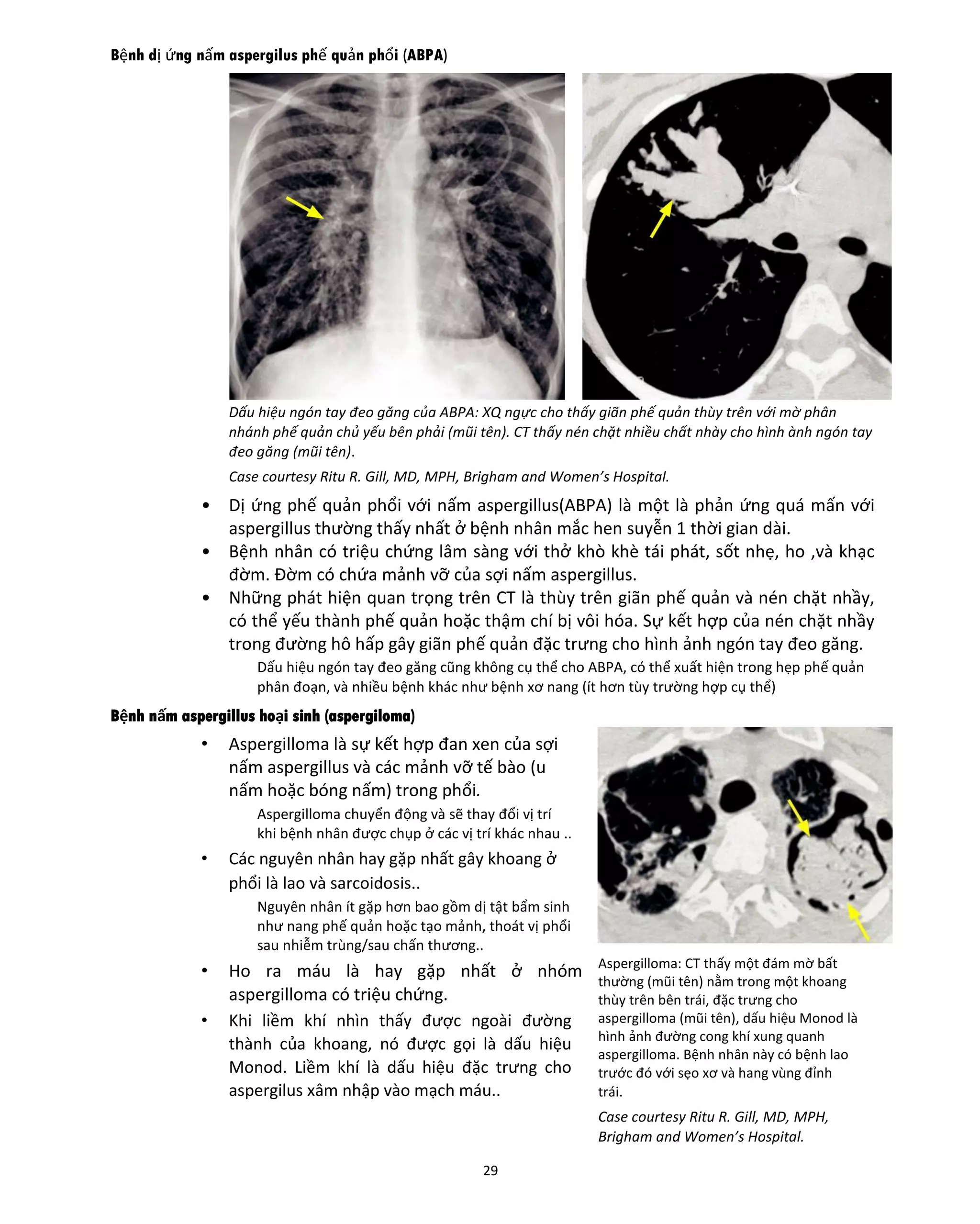 Core_Radiology_A_Visual_Approach_to_Diagnostic_Imaging_914trangvi.pdf