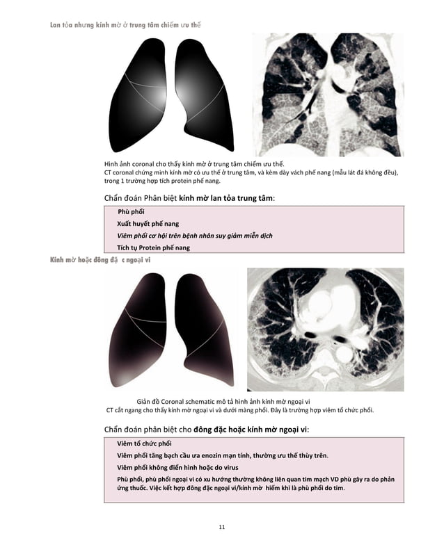 Core_Radiology_A_Visual_Approach_to_Diagnostic_Imaging_914trangvi.pdf