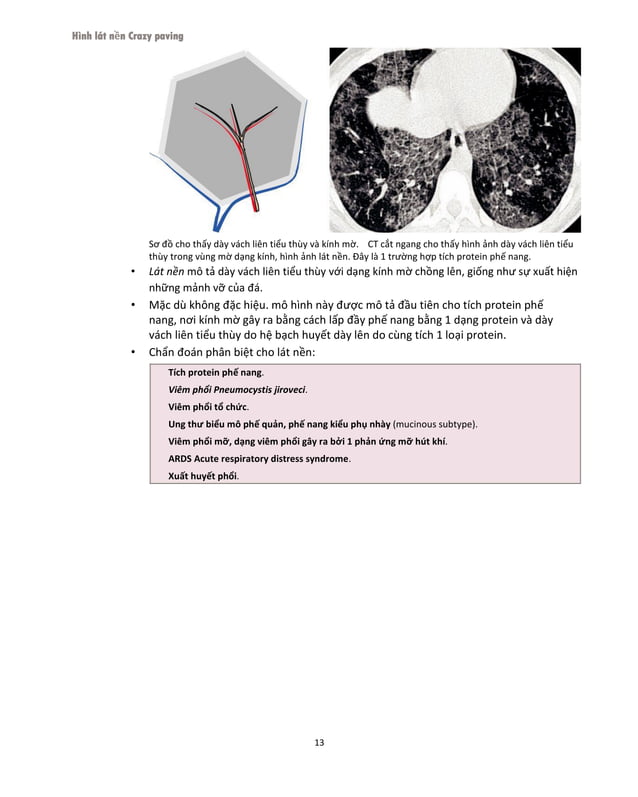 Core_Radiology_A_Visual_Approach_to_Diagnostic_Imaging_914trangvi.pdf