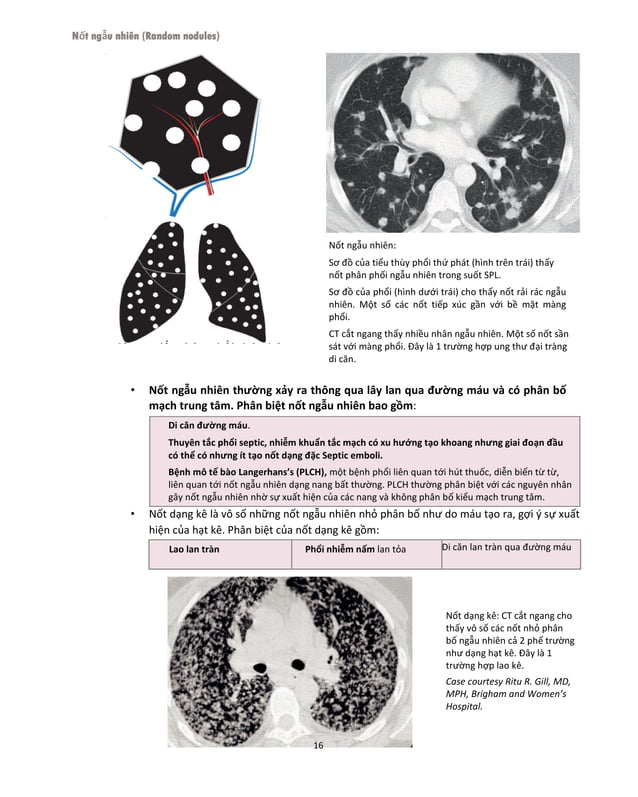Core_Radiology_A_Visual_Approach_to_Diagnostic_Imaging_914trangvi.pdf