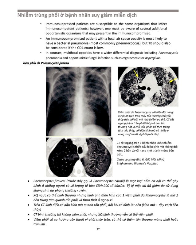 Core_Radiology_A_Visual_Approach_to_Diagnostic_Imaging_914trangvi.pdf