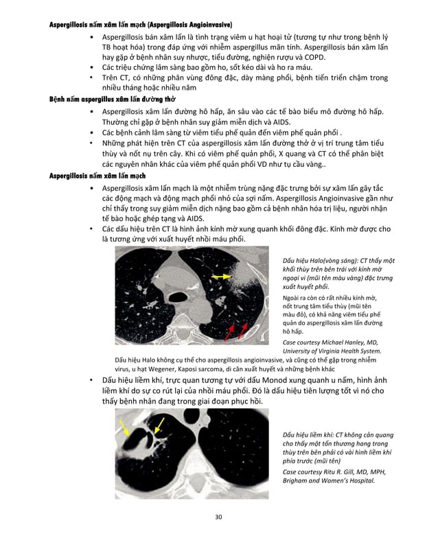 Core_Radiology_A_Visual_Approach_to_Diagnostic_Imaging_914trangvi.pdf