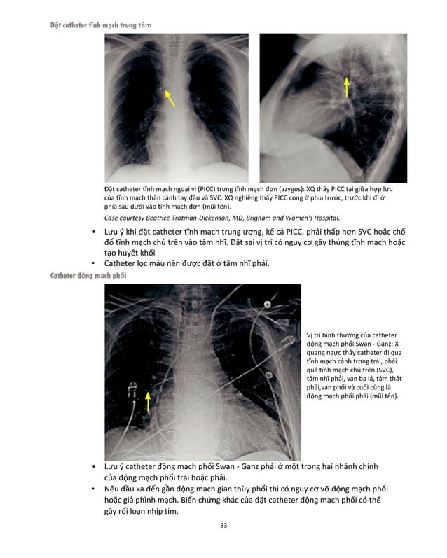 Core_Radiology_A_Visual_Approach_to_Diagnostic_Imaging_914trangvi.pdf
