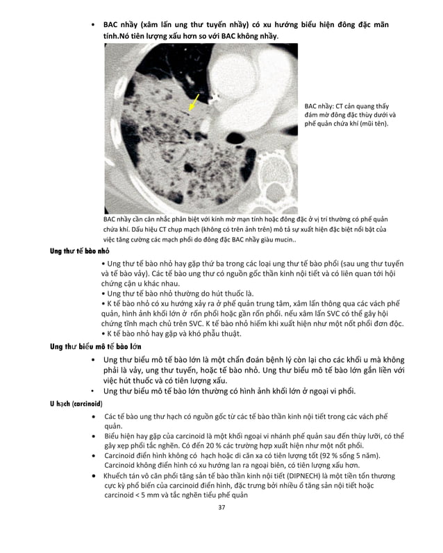 Core_Radiology_A_Visual_Approach_to_Diagnostic_Imaging_914trangvi.pdf