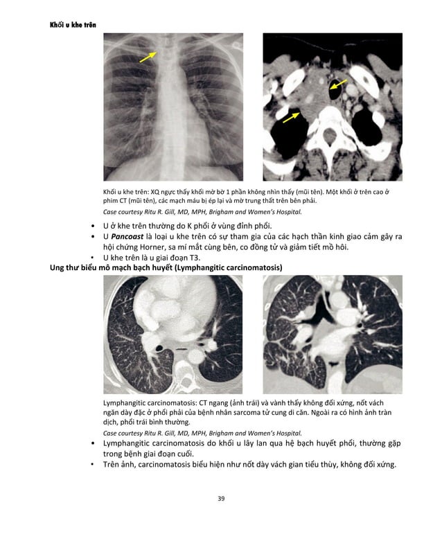 Core_Radiology_A_Visual_Approach_to_Diagnostic_Imaging_914trangvi.pdf