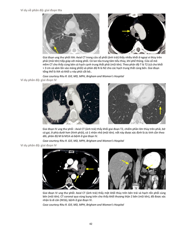 Core_Radiology_A_Visual_Approach_to_Diagnostic_Imaging_914trangvi.pdf