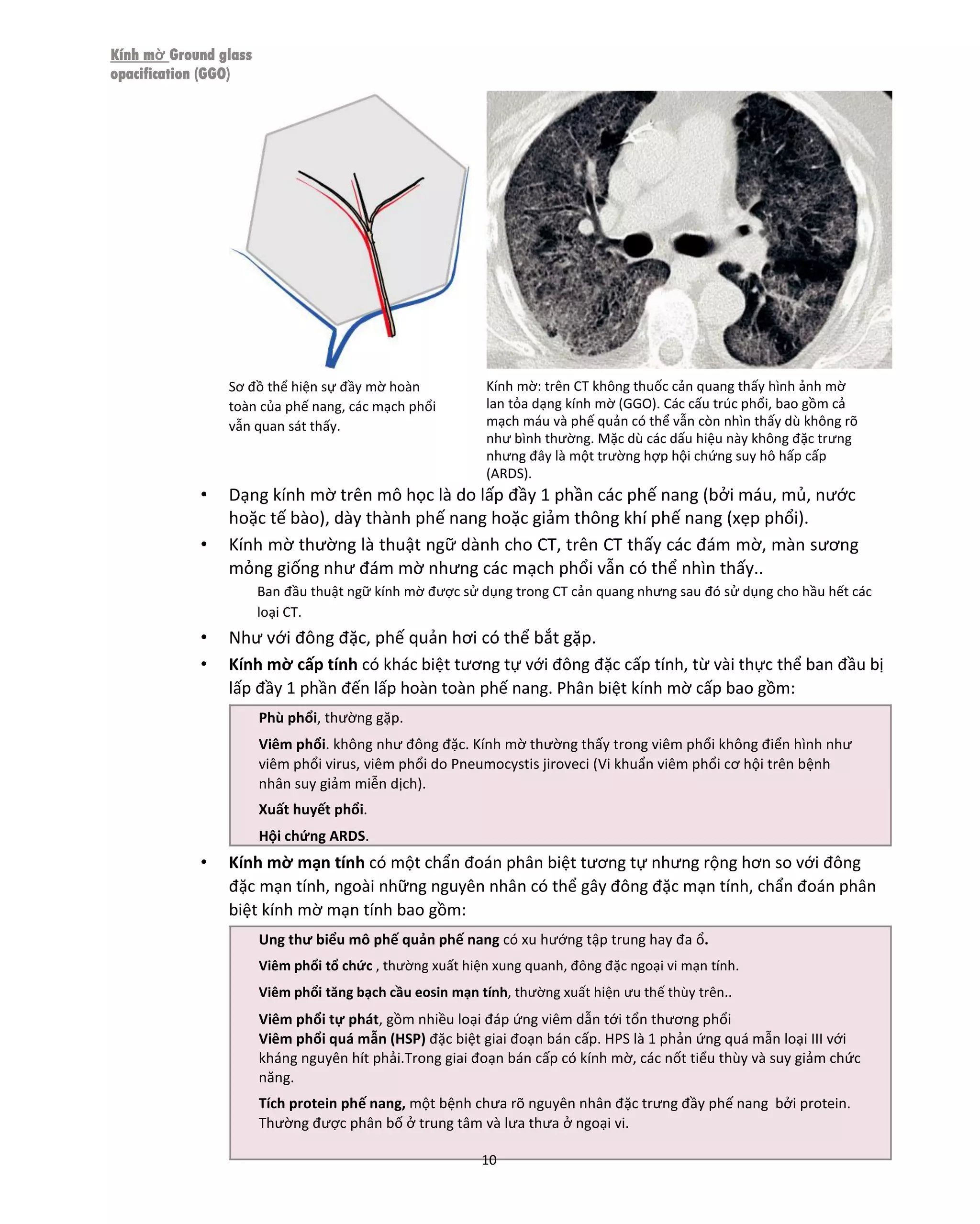 Core_Radiology_A_Visual_Approach_to_Diagnostic_Imaging_914trangvi (1).pdf