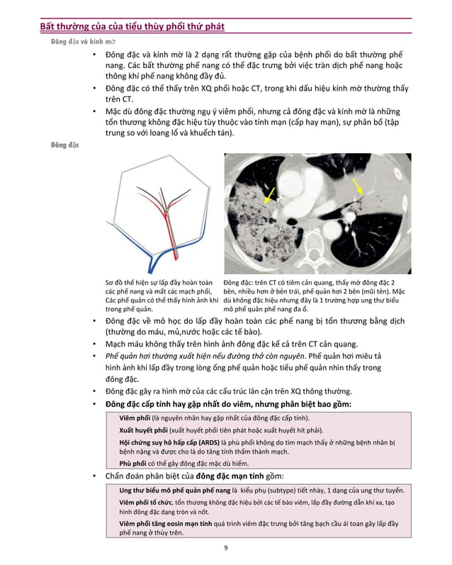 Core_Radiology_A_Visual_Approach_to_Diagnostic_Imaging_914trangvi (1).pdf