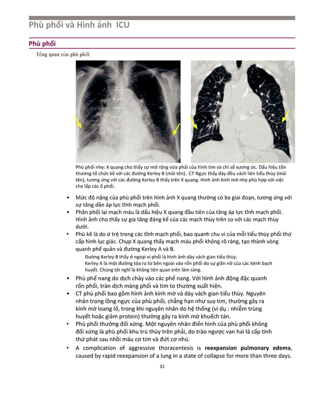 Core_Radiology_A_Visual_Approach_to_Diagnostic_Imaging_914trangvi (1).pdf