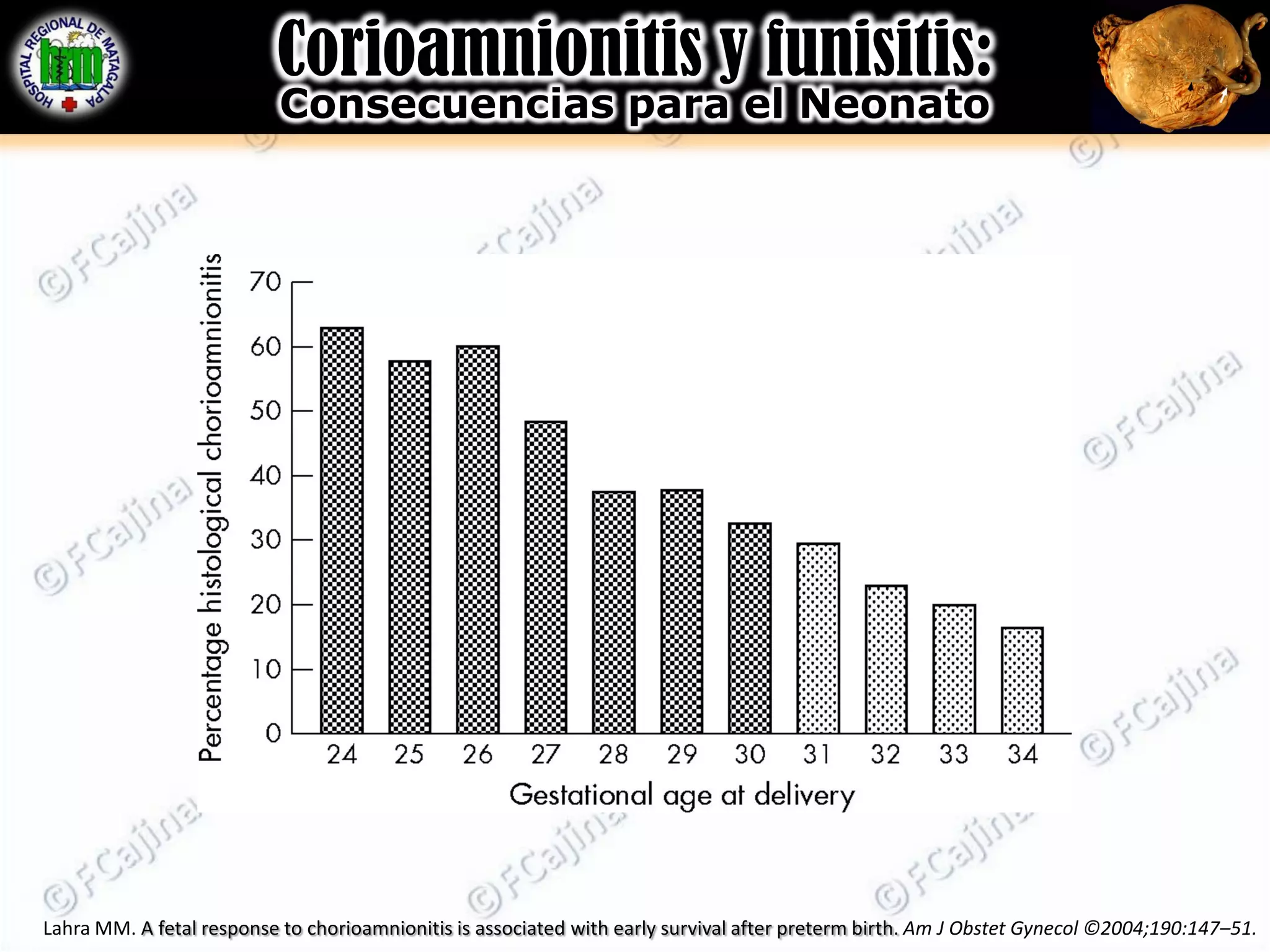 Corioamnionitis y funisitis. consecuencias para el neonato | PDF