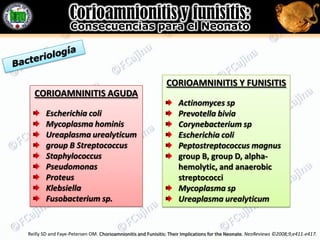 Corioamnionitis y funisitis. consecuencias para el neonato | PDF