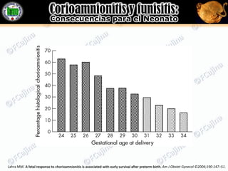 Corioamnionitis y funisitis. consecuencias para el neonato | PDF