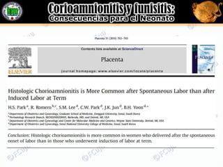 Corioamnionitis y funisitis. consecuencias para el neonato | PDF