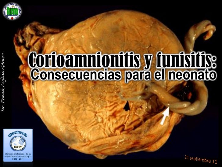 Corioamnionitis y funisitis. consecuencias para el neonato