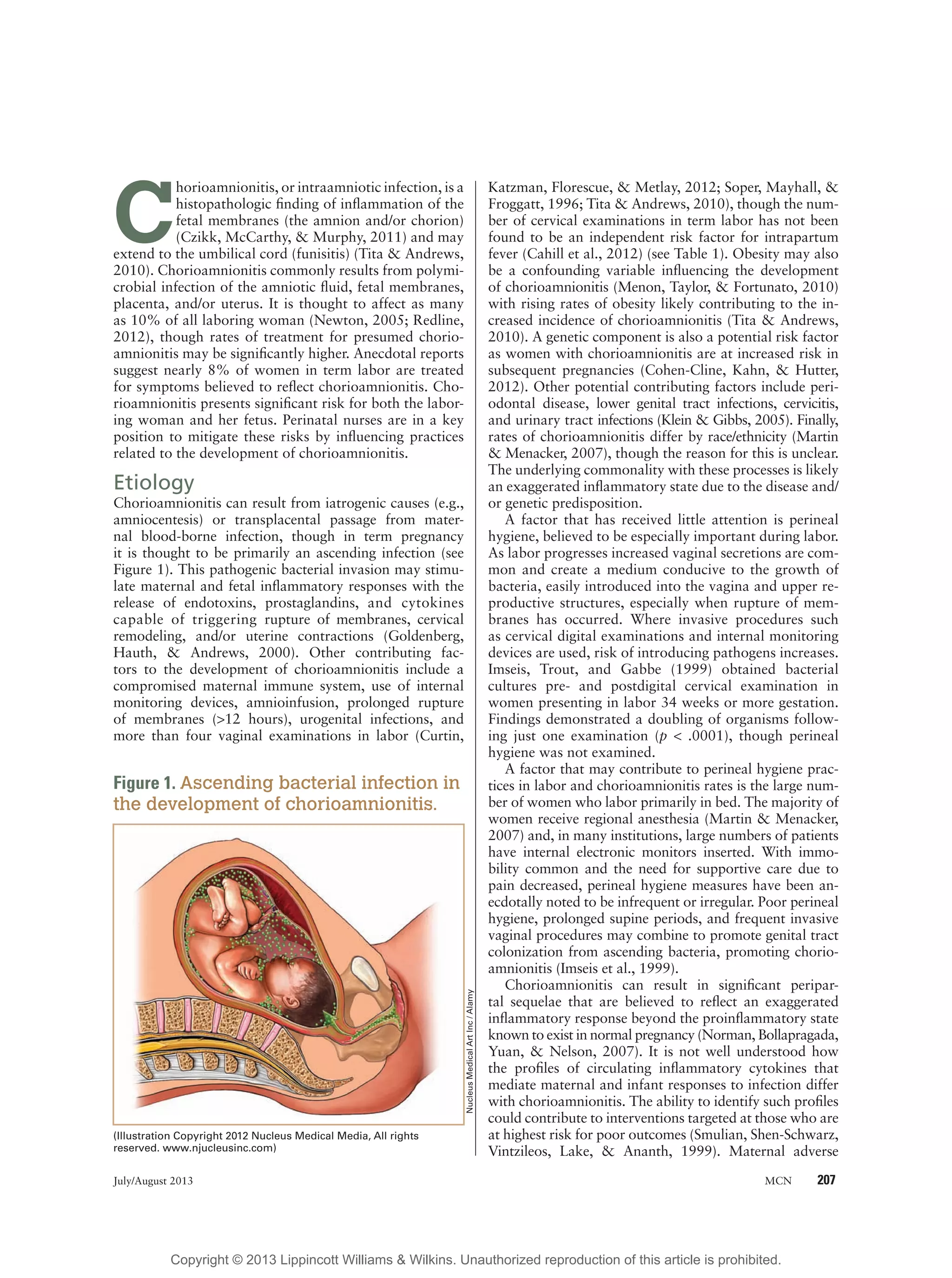 Corioamnionitis | PDF