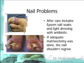 Corn And Nail Presentataion To Residents | PPT