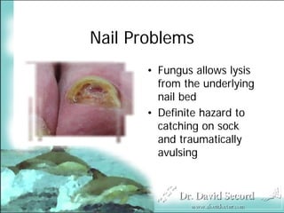 Corn And Nail Presentataion To Residents | PPT