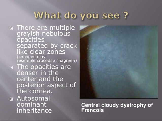 Common Cases: Cornea