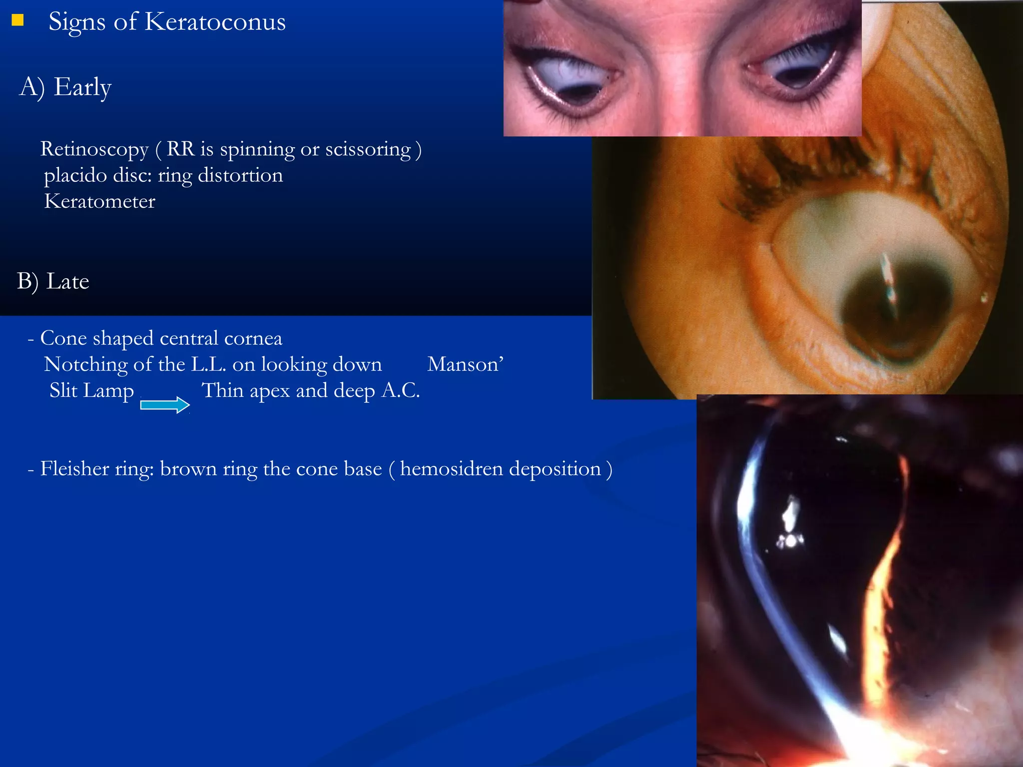 Cornea for undergraduate | PPT