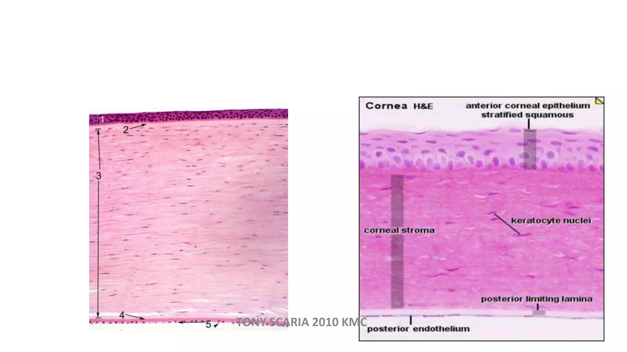Cornea REVISION NOTES | PPT
