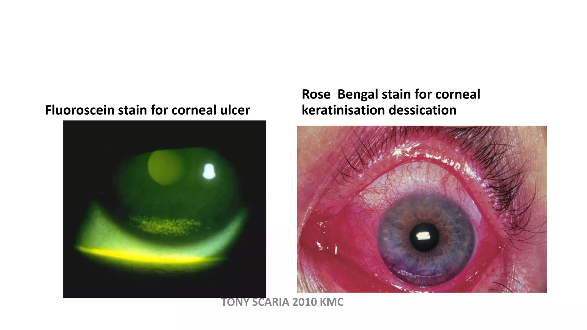 Cornea REVISION NOTES | PPT