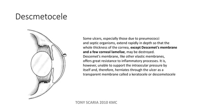 Cornea REVISION NOTES | PPT