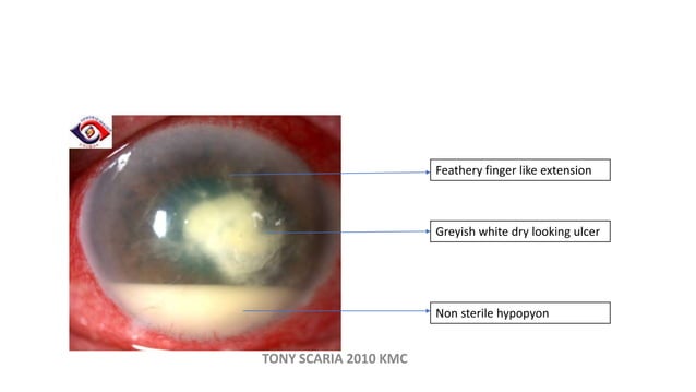 Cornea REVISION NOTES | PPT