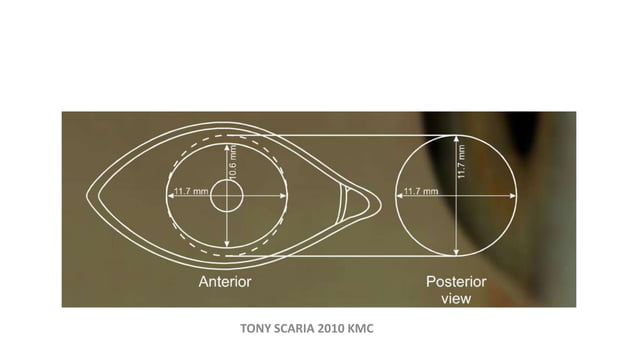 Cornea REVISION NOTES | PPT