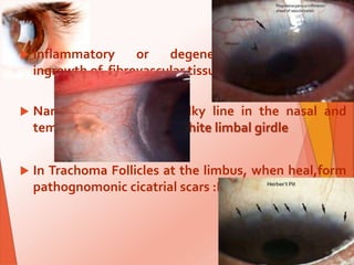 Cornea: Brief Introduction | PPT