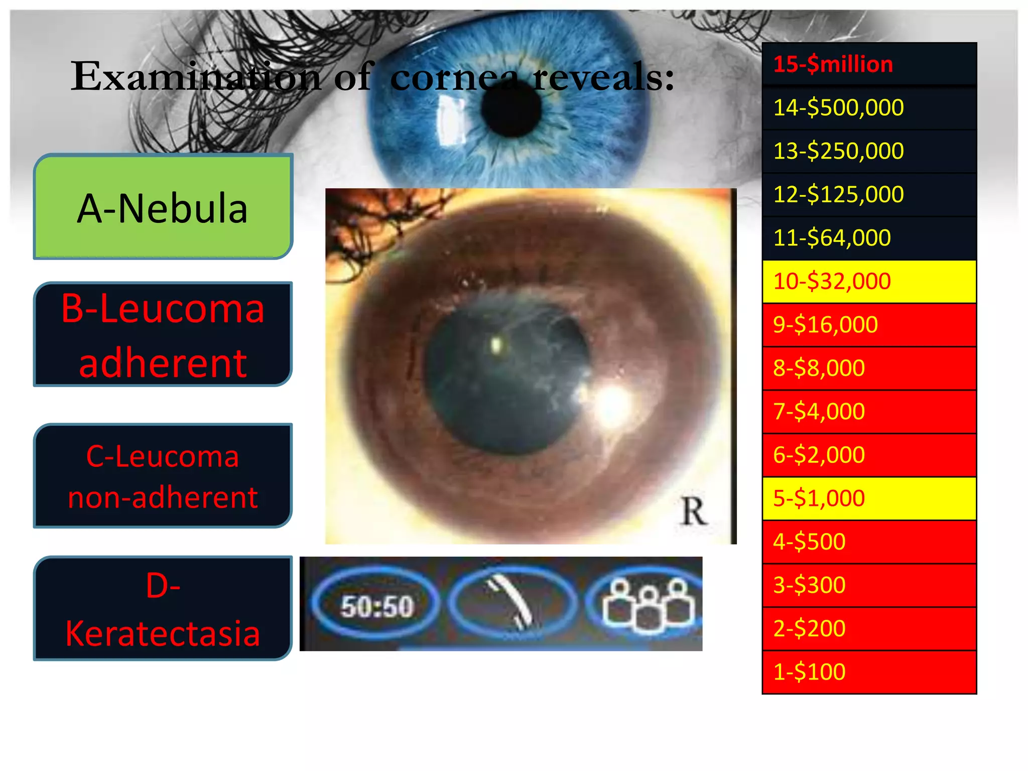 Cornea.ppt