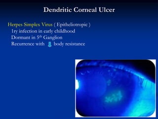Cornea.ppt