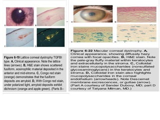 Congenital and acquired corneal pathology.pptx