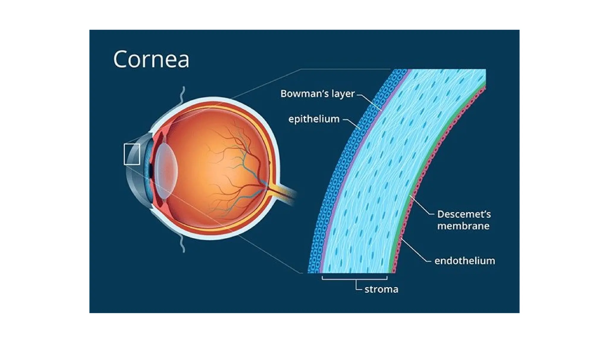 Cornea - Anatomy and Pathology - Pathology - Optometry | PPTX