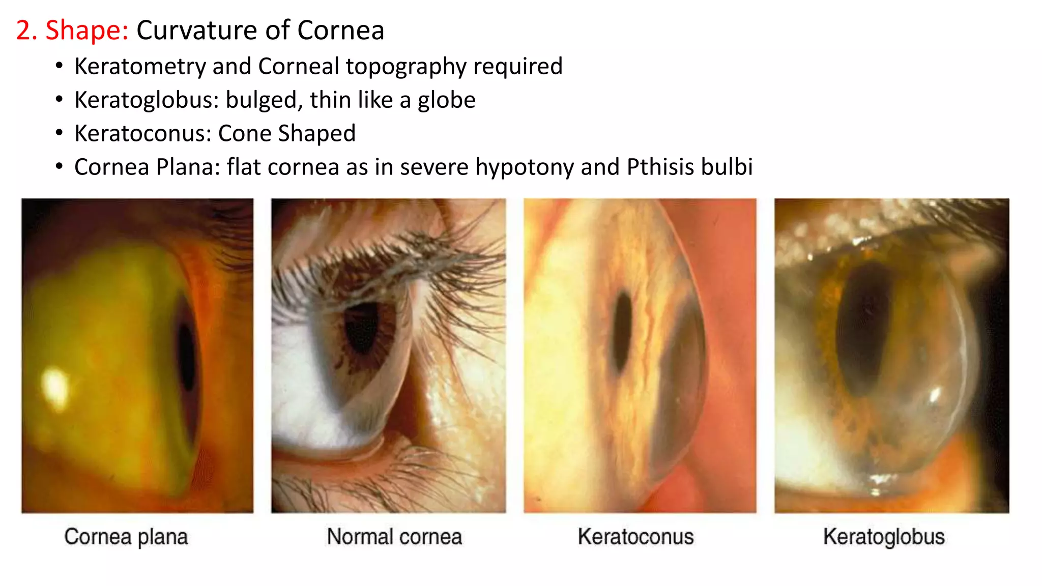 Cornea- Anatomy & Physiology.pptx