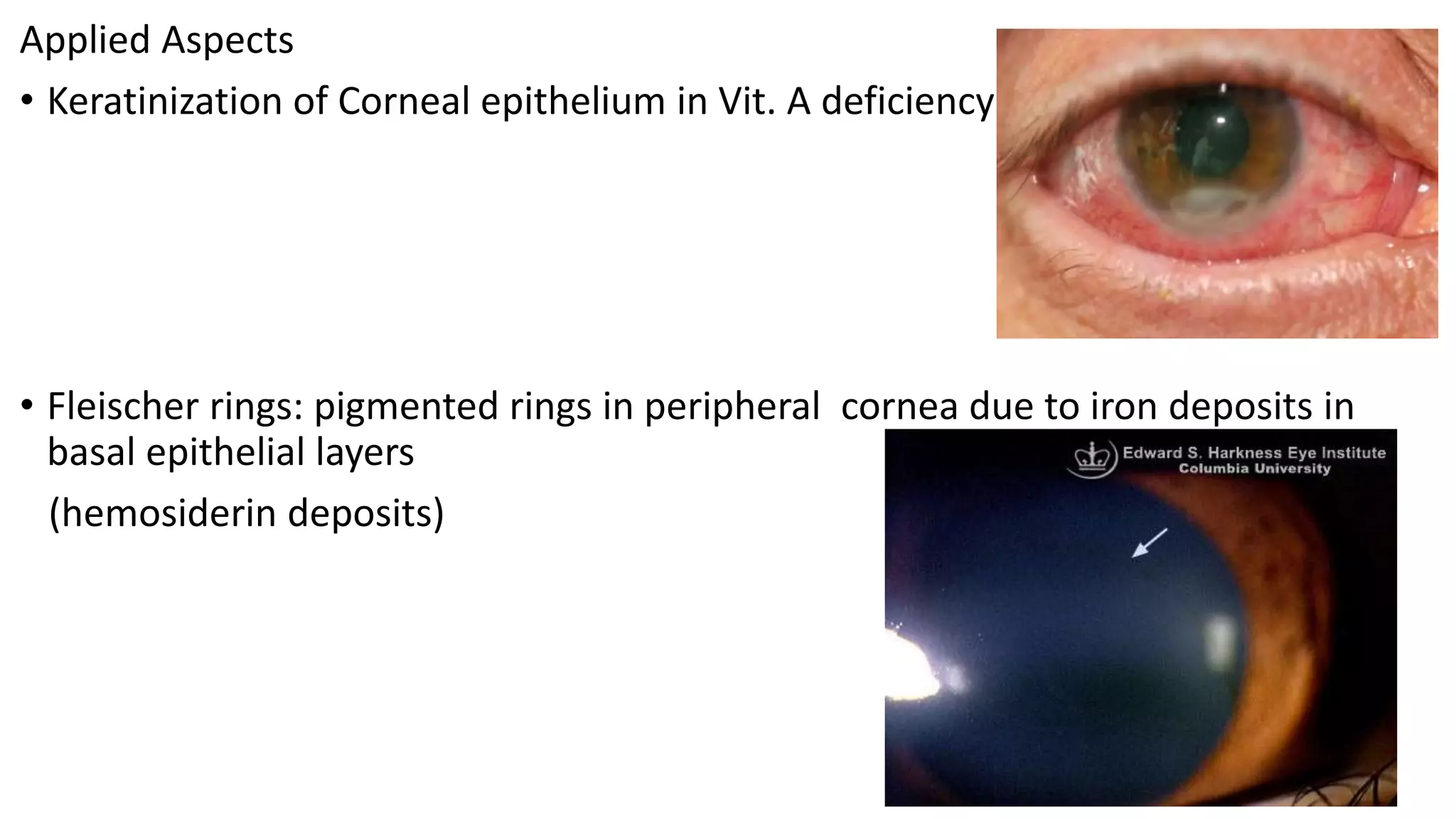 Cornea- Anatomy & Physiology.pptx
