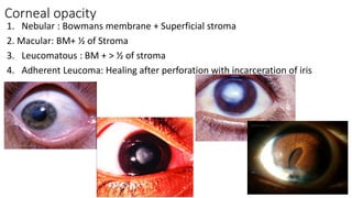 Cornea- Anatomy & Physiology.pptx
