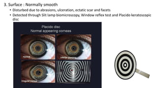 Cornea- Anatomy & Physiology.pptx