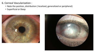 Cornea- Anatomy & Physiology.pptx