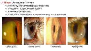 Cornea- Anatomy & Physiology.pptx