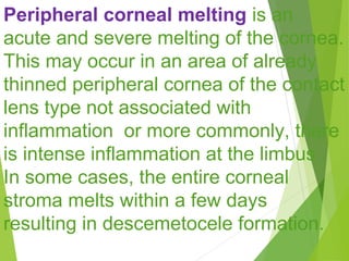 Diseases of Cornea Keratitis | PPT